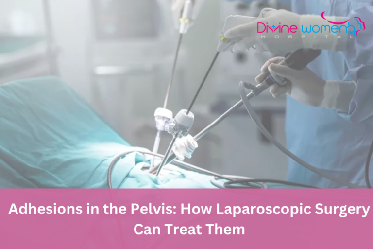 Adhesions in the Pelvis: How Laparoscopic Surgery Can Treat Them
